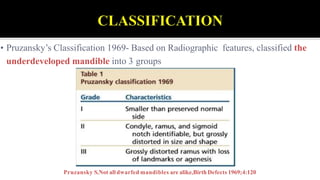 Facial asymmetry condylar hyperplasia and hemifacial microsomia | PPT