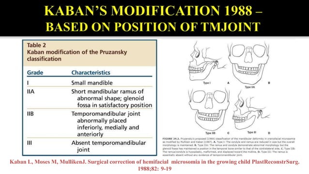 Facial Asymmetry Condylar Hyperplasia And Hemifacial Microsomia