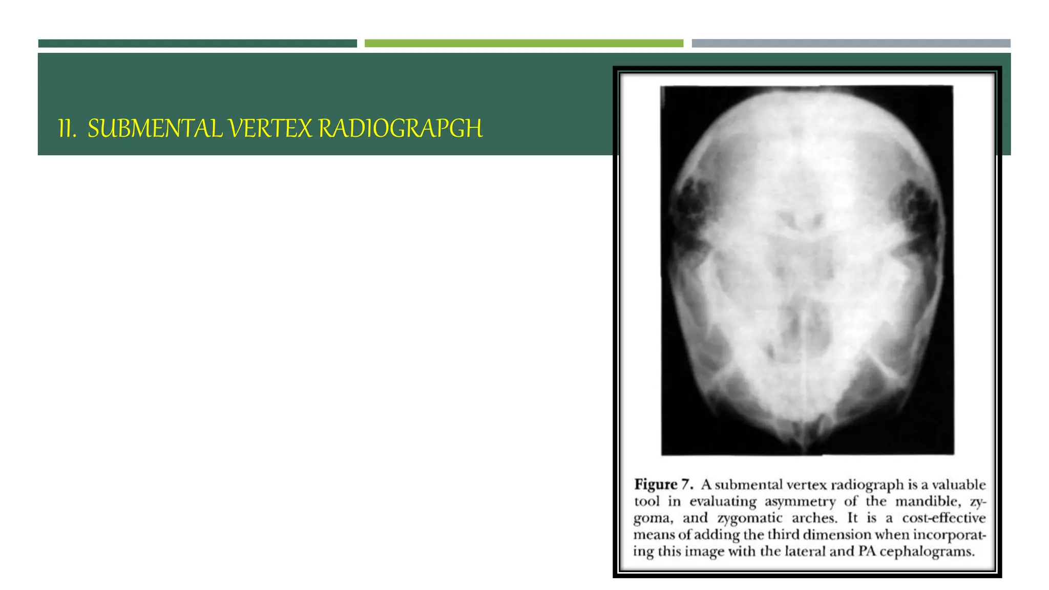 facial asymmetry ppt management in orthodontics .pptx
