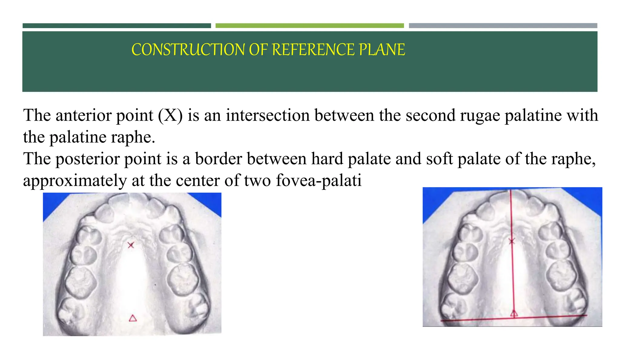facial asymmetry ppt management in orthodontics .pptx