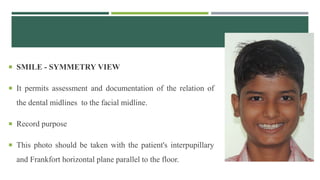 facial asymmetry ppt management in orthodontics .pptx