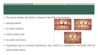 facial asymmetry ppt management in orthodontics .pptx