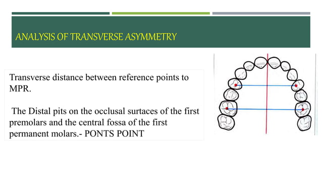 facial asymmetry ppt management in orthodontics .pptx | Dental Health ...