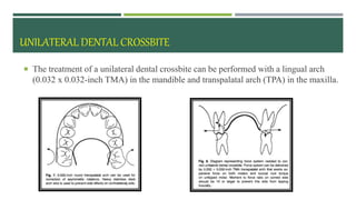 facial asymmetry ppt management in orthodontics .pptx