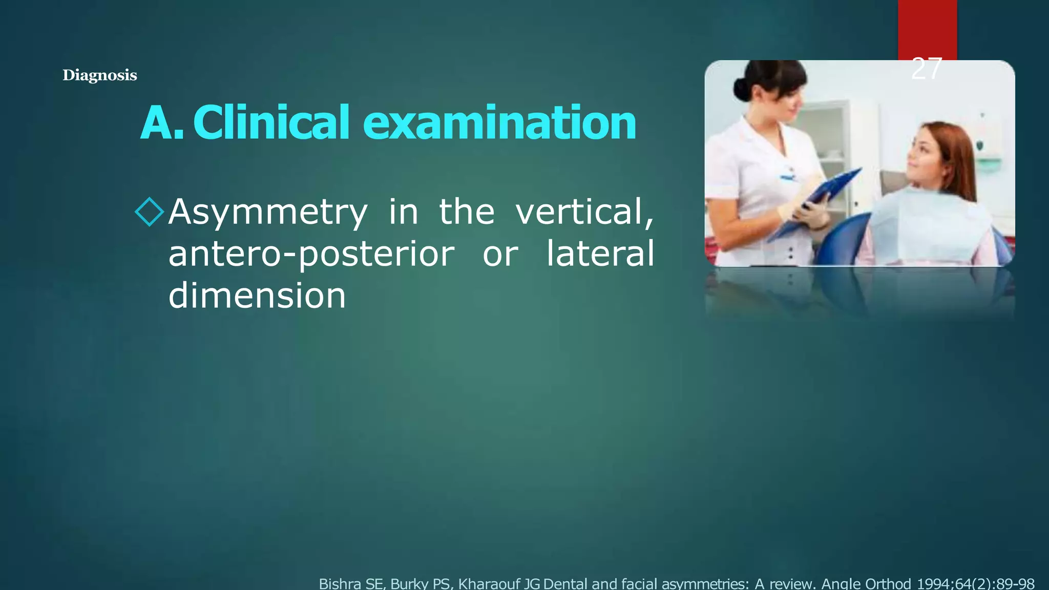 Facial Asymmetry | PPTX