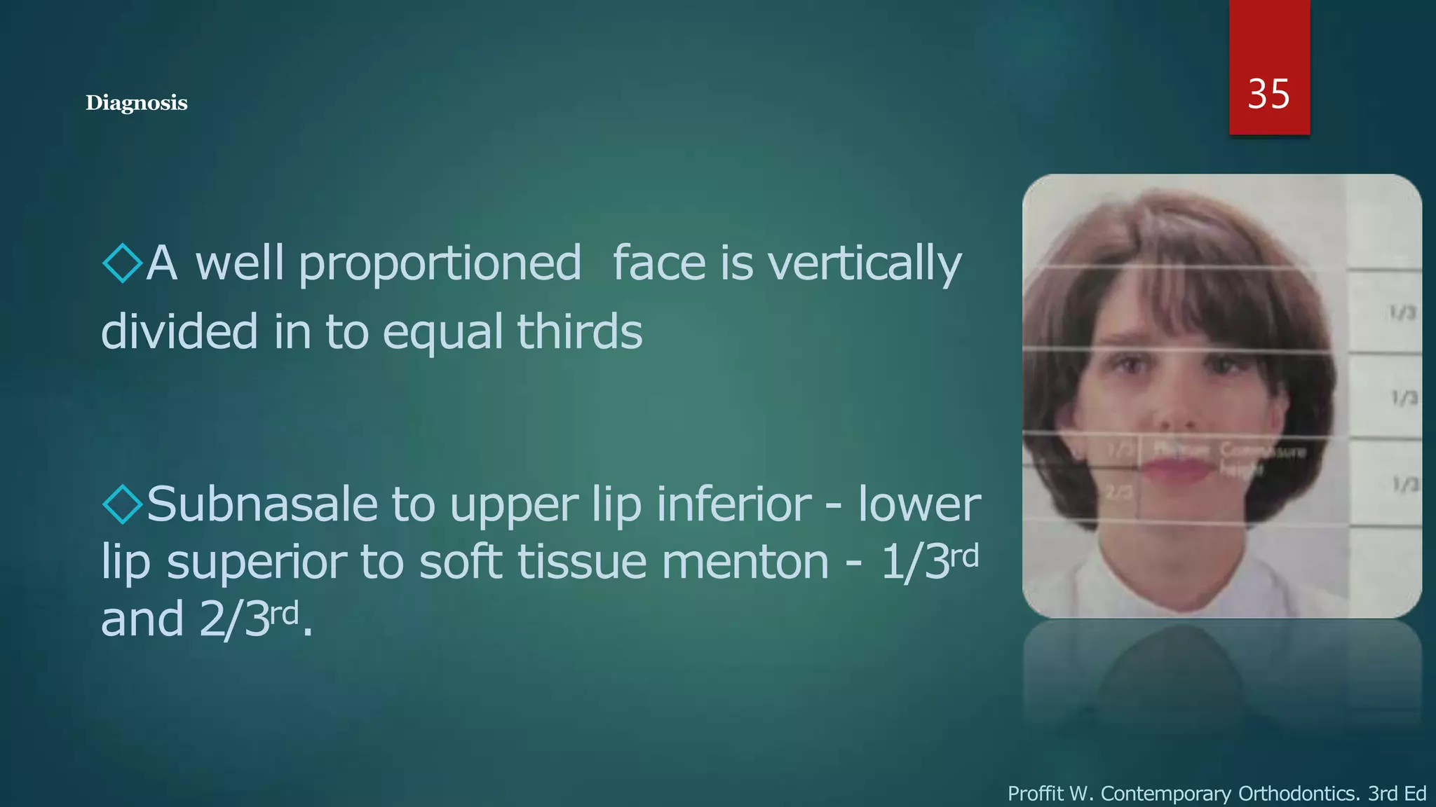 Facial Asymmetry | PPTX