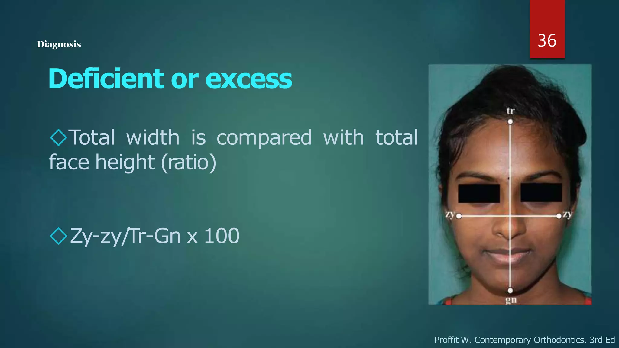 Facial Asymmetry | PPTX