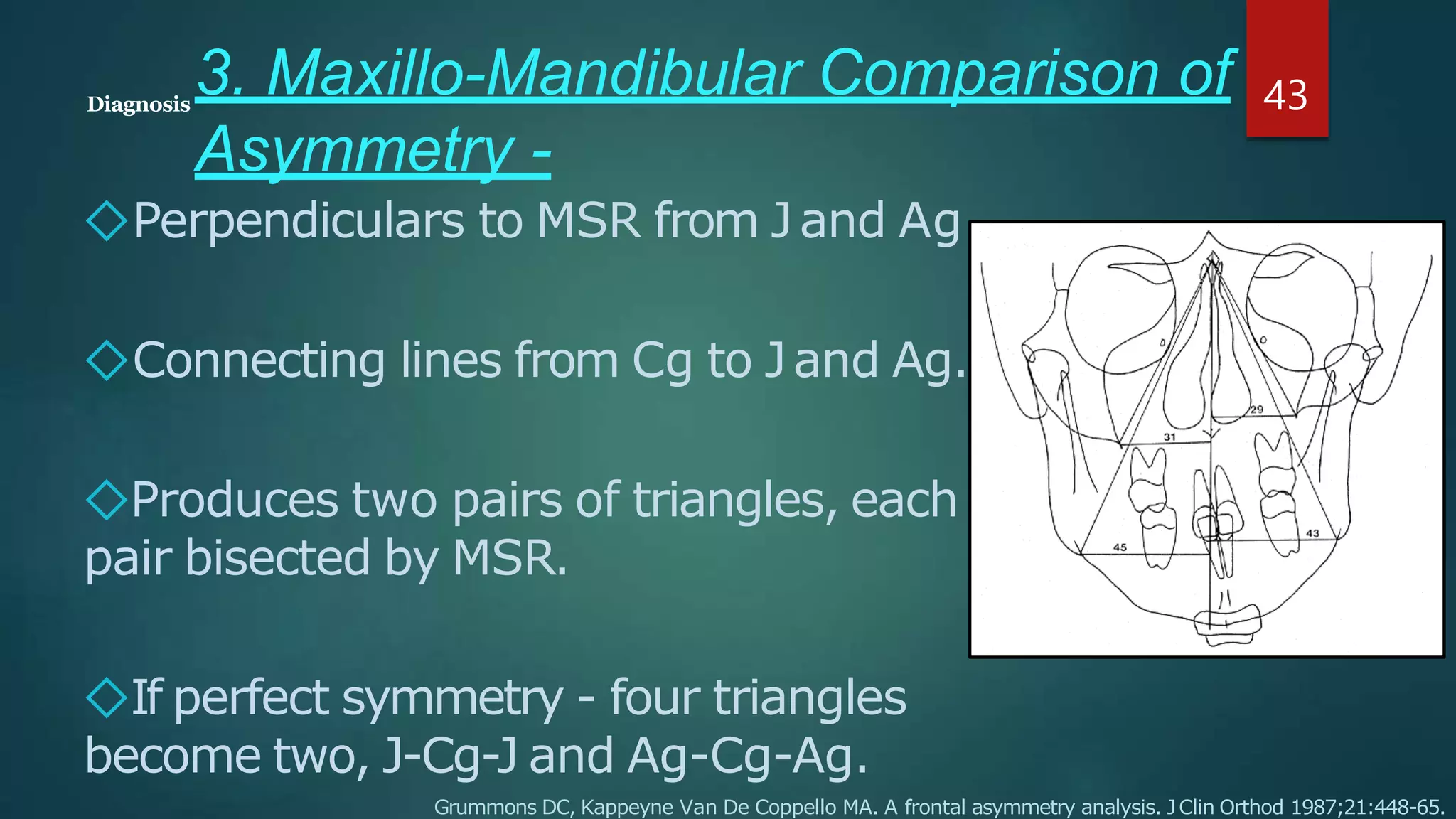 Facial Asymmetry | PPTX