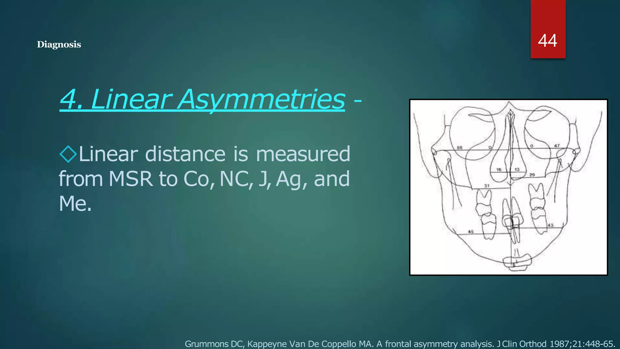 Facial Asymmetry | PPTX