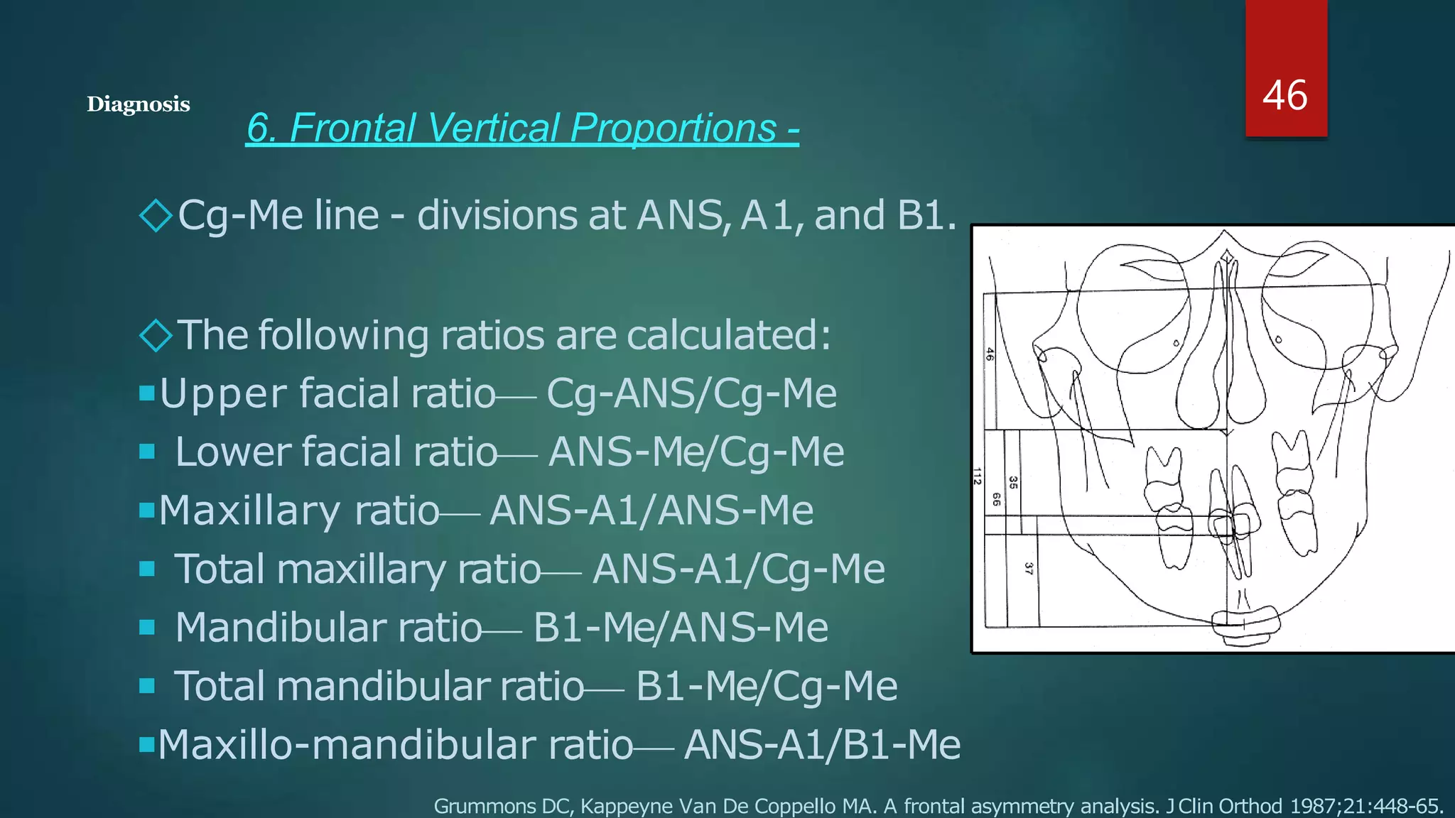 Facial Asymmetry | PPTX