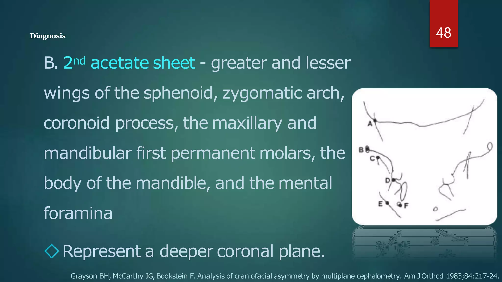 Facial Asymmetry | PPTX
