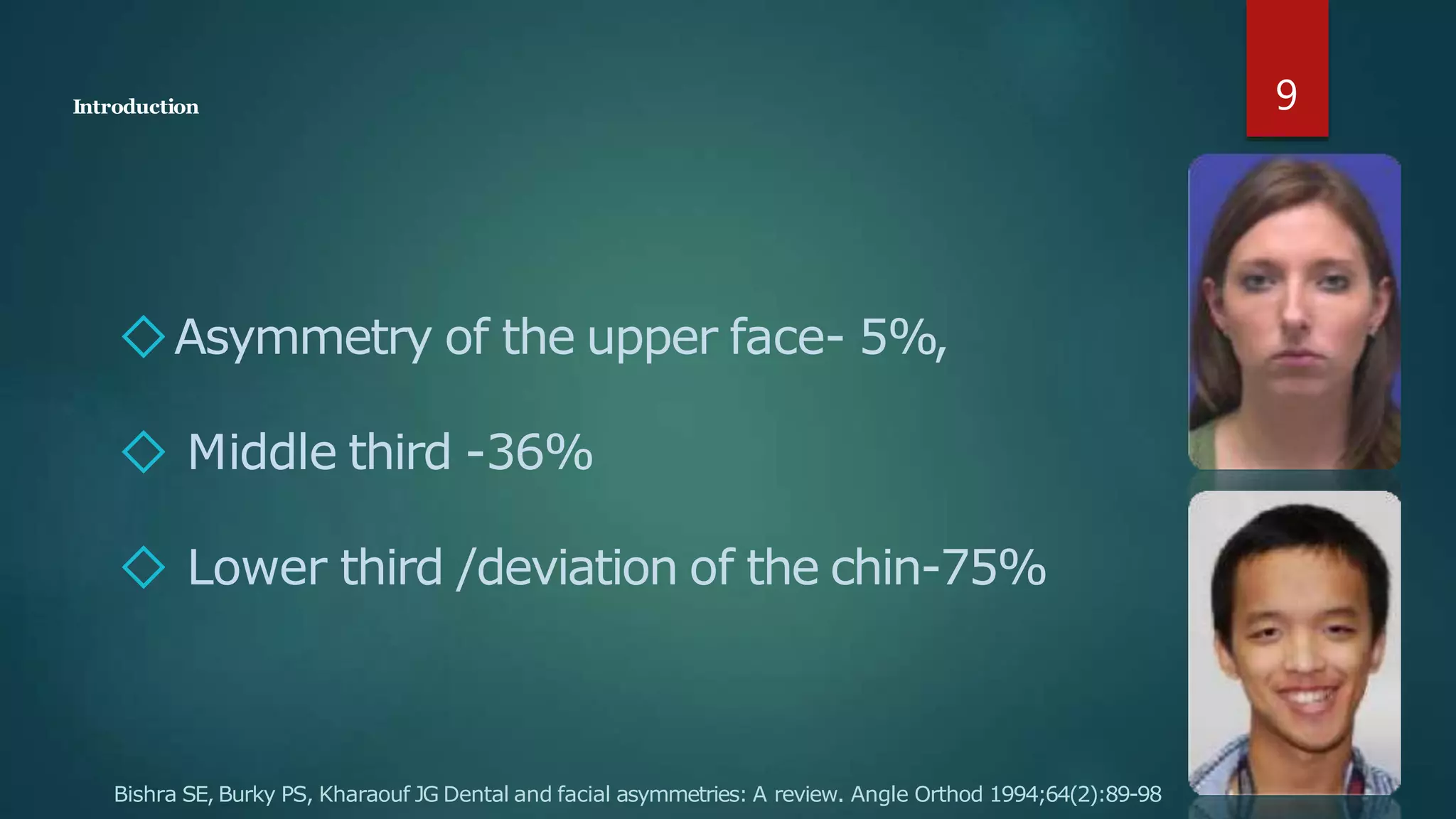 Facial Asymmetry | PPTX