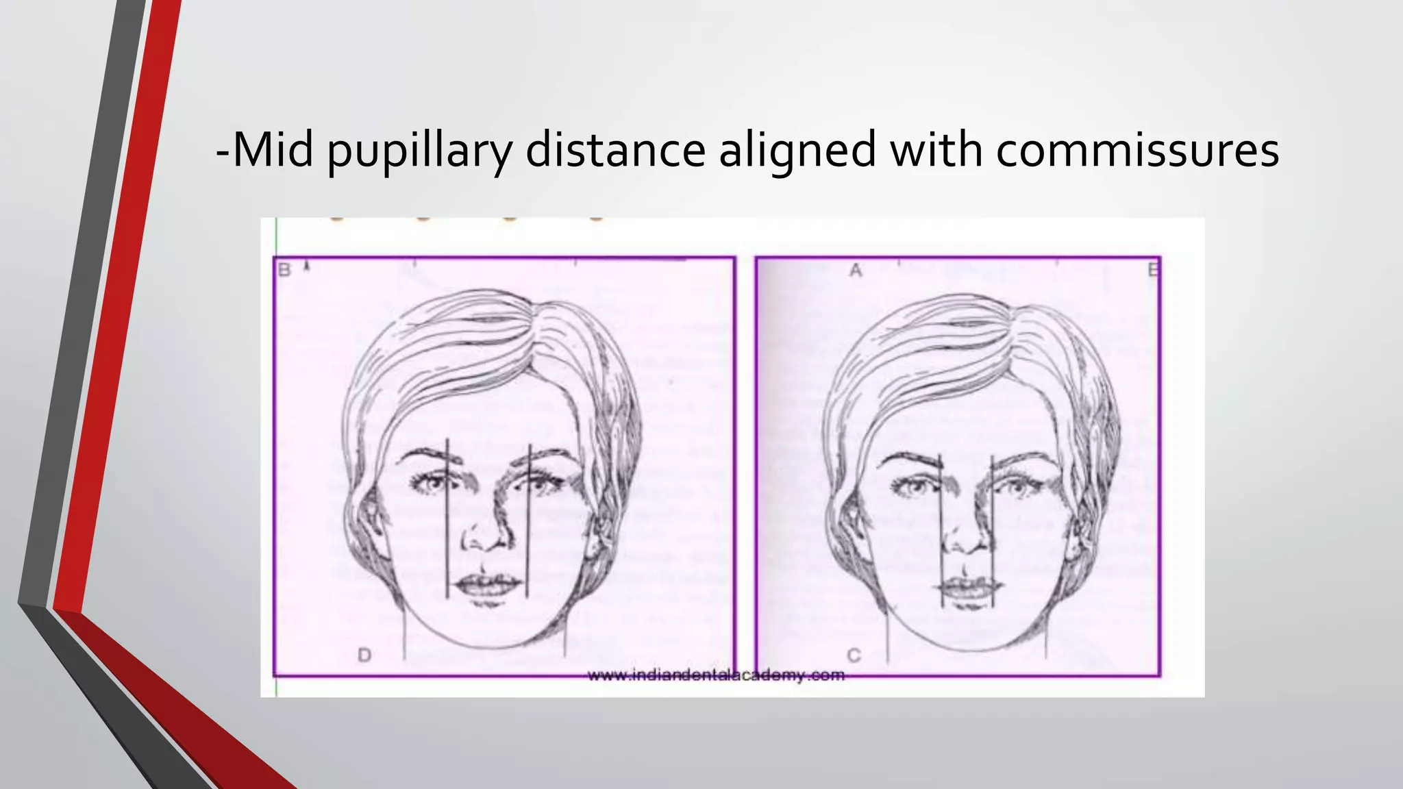 Management of Facial asymmetry | PPTX