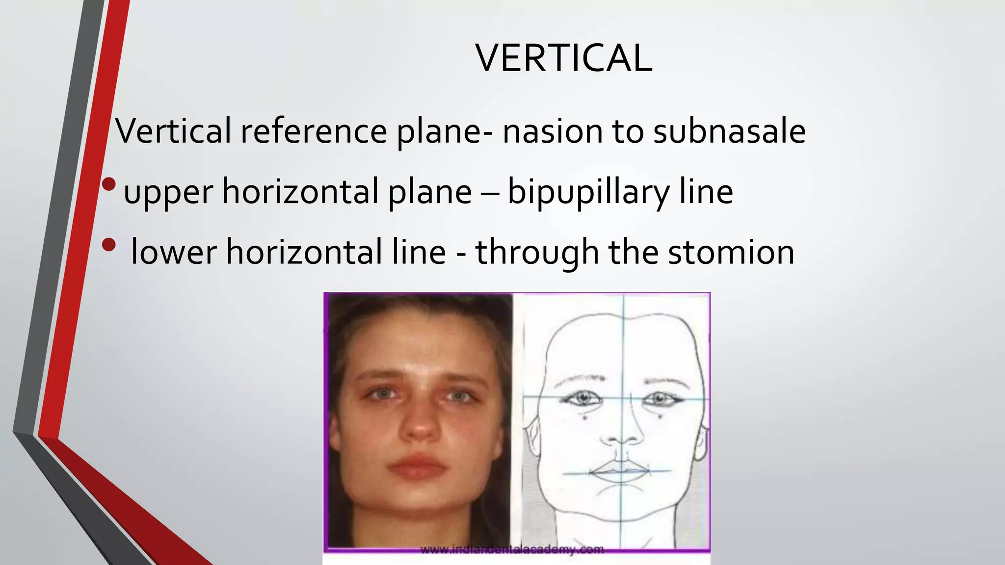 Management of Facial asymmetry | PPTX | Dental Health | Diseases and ...