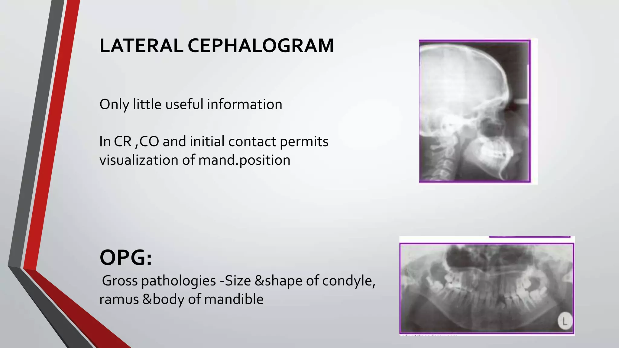 Management of Facial asymmetry | PPTX