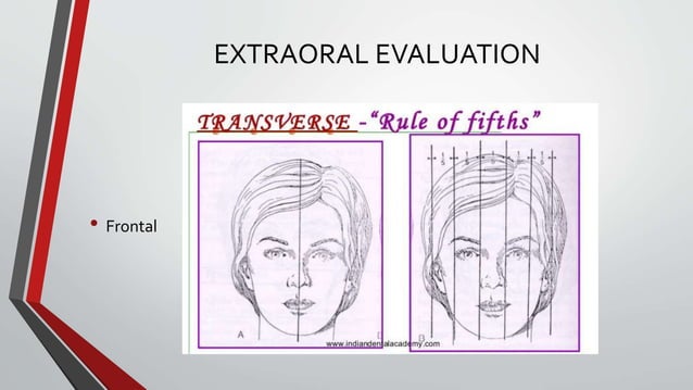 Management of Facial asymmetry | PPTX | Dental Health | Diseases and ...