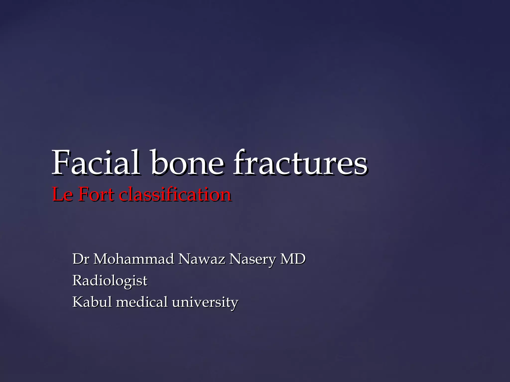 Facial bone fracture | PPT