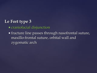 Facial bone fracture | PPT