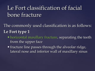 Facial bone fracture | PPT