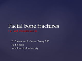 Facial bone fracture | PPT