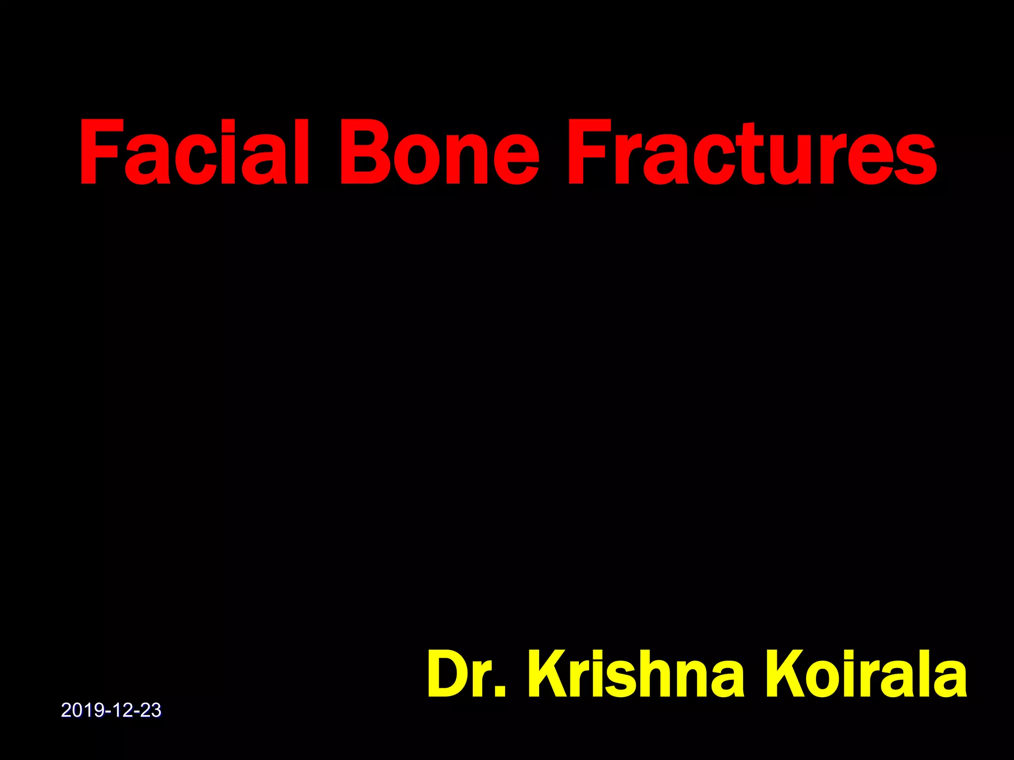 Facial bone fractures | PPT