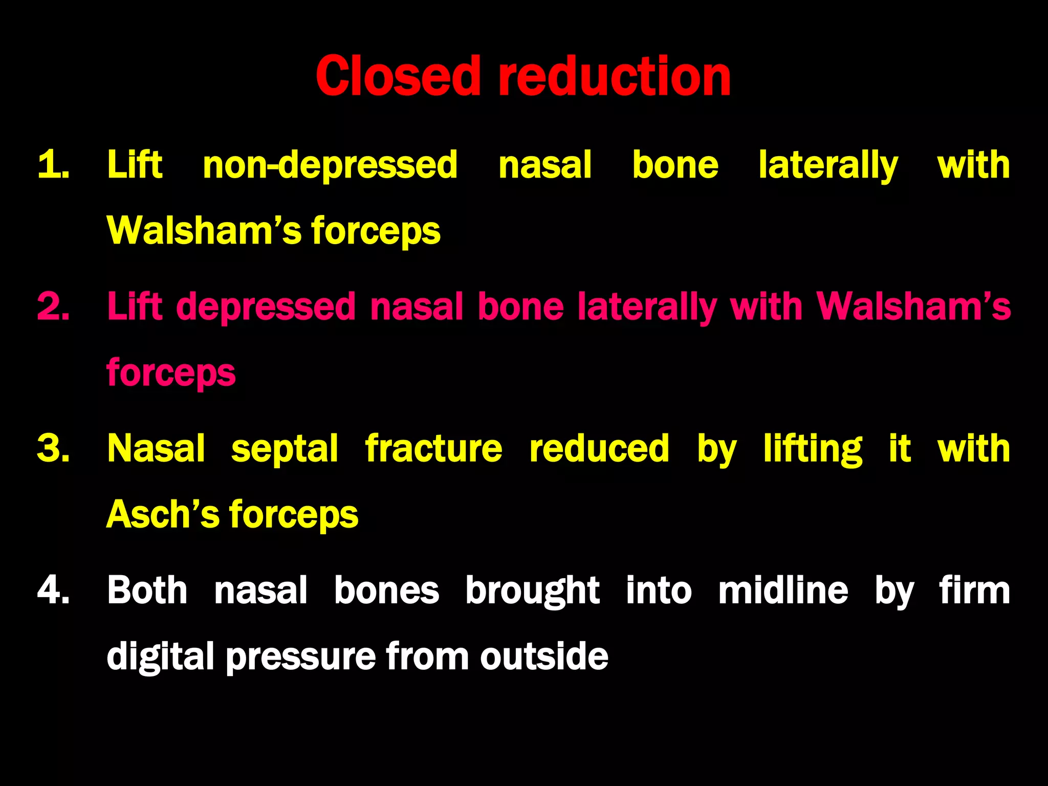 Facial bone fractures | PPT