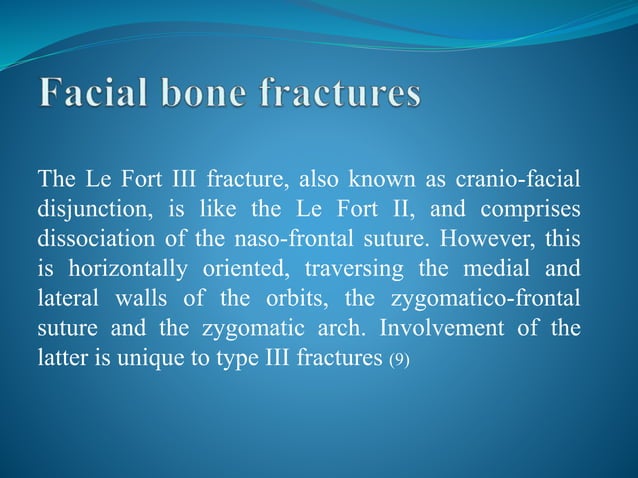 Facial bone fractures an overview | PPTX | Death, Injury, or Military ...