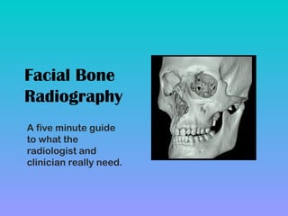 - SURGICAL Facial_Bones_Power_Point_pptx.pptx