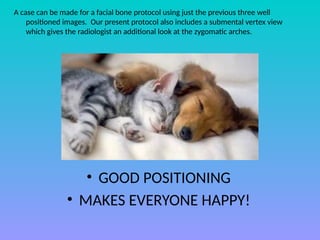 - SURGICAL Facial_Bones_Power_Point_pptx.pptx