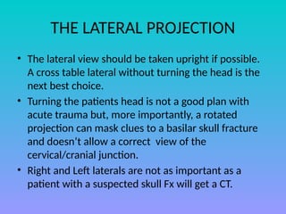 - SURGICAL Facial_Bones_Power_Point_pptx.pptx