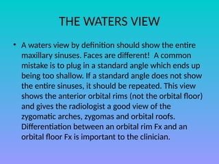 - SURGICAL Facial_Bones_Power_Point_pptx.pptx