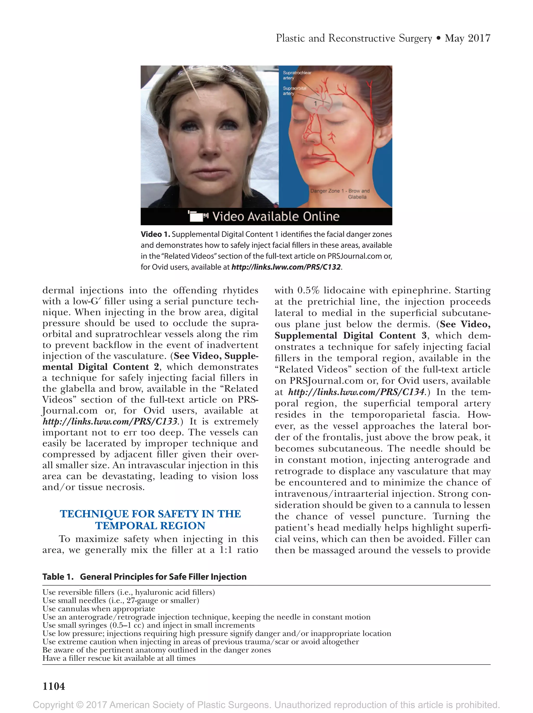 Facial danger zones techniques to maximize safety during soft tissue ...