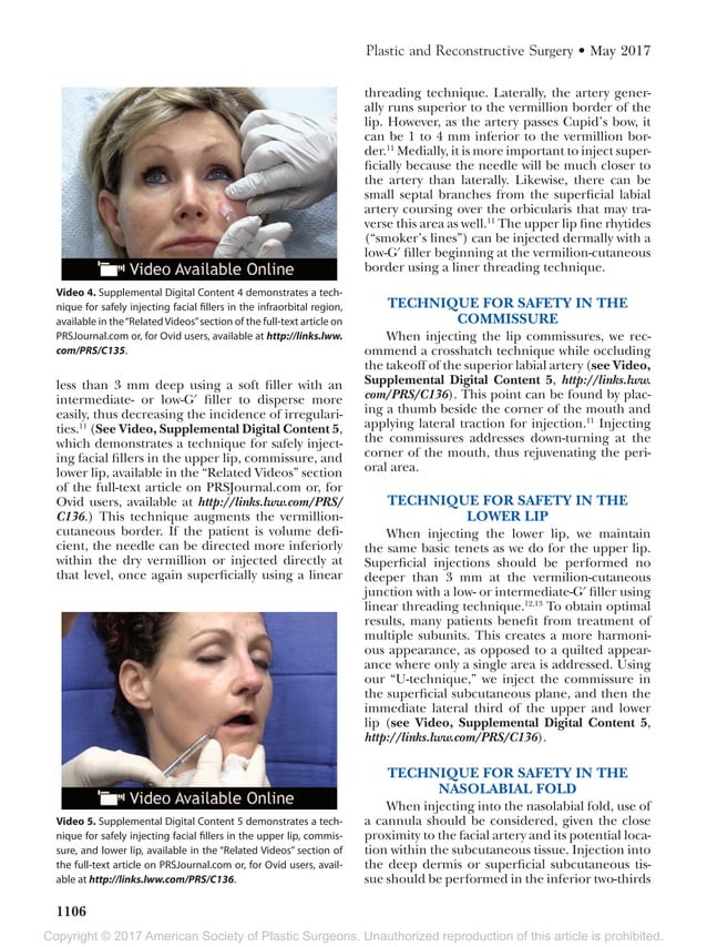 Facial danger zones techniques to maximize safety during soft tissue ...