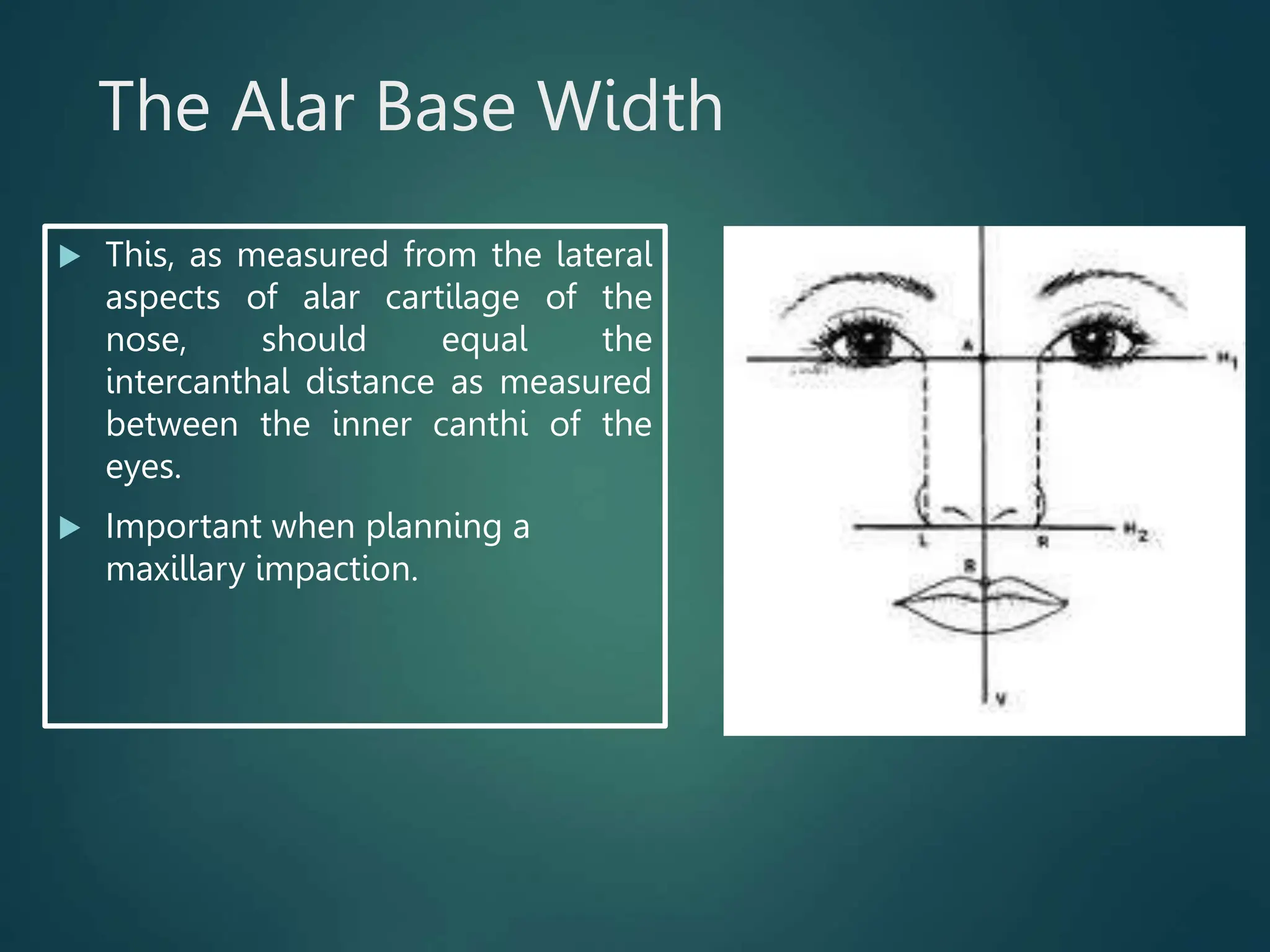 Facial Deformities Management: Orthognathic Surgery From Diagnosis to ...