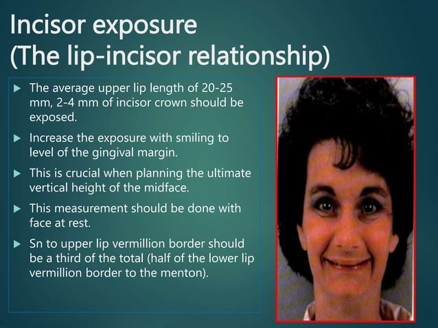 Facial Deformities Management: Orthognathic Surgery From Diagnosis to ...