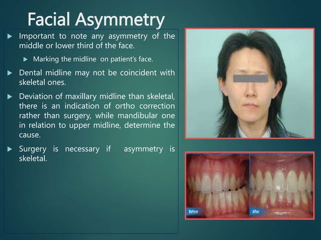 Facial Deformities Management: Orthognathic Surgery From Diagnosis to ...
