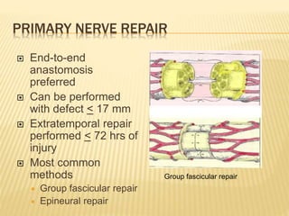 Facial nerve, its disorders & management | PPTX
