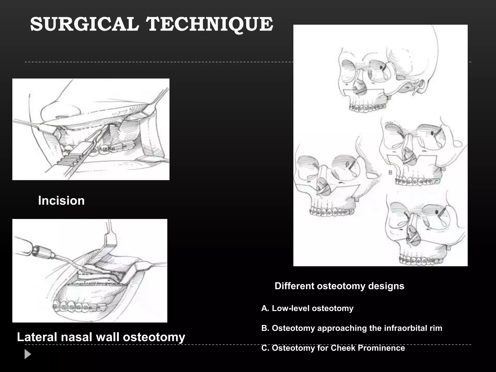 FACIAL ESTHETIC SURGERY.pptx