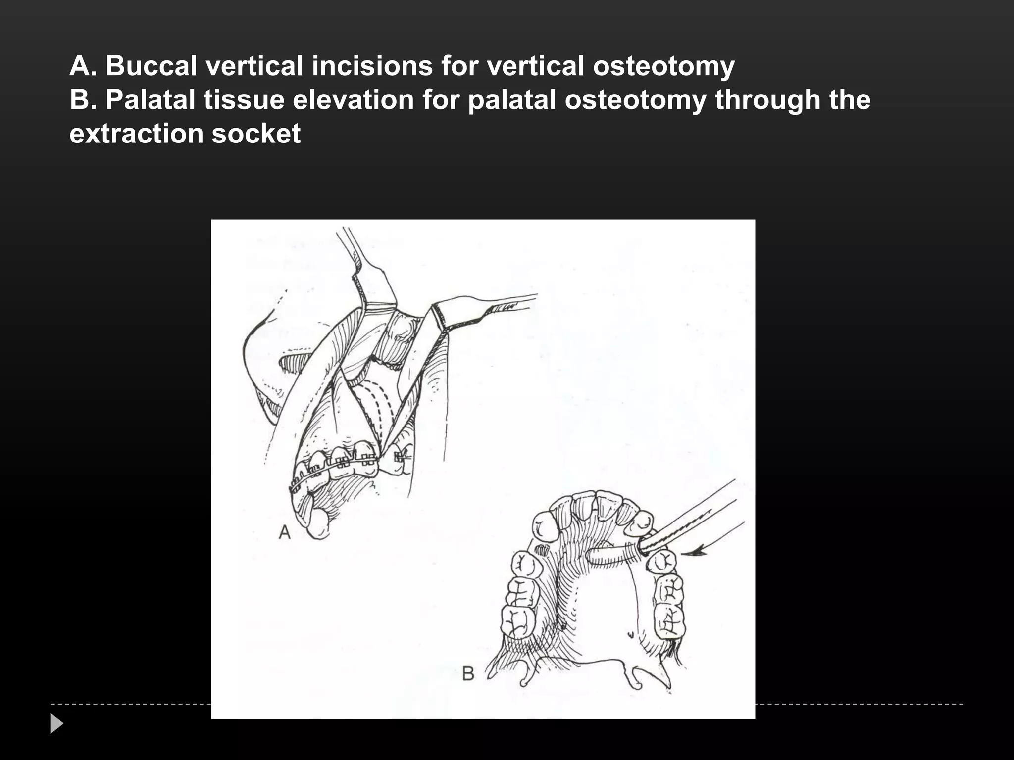 FACIAL ESTHETIC SURGERY.pptx
