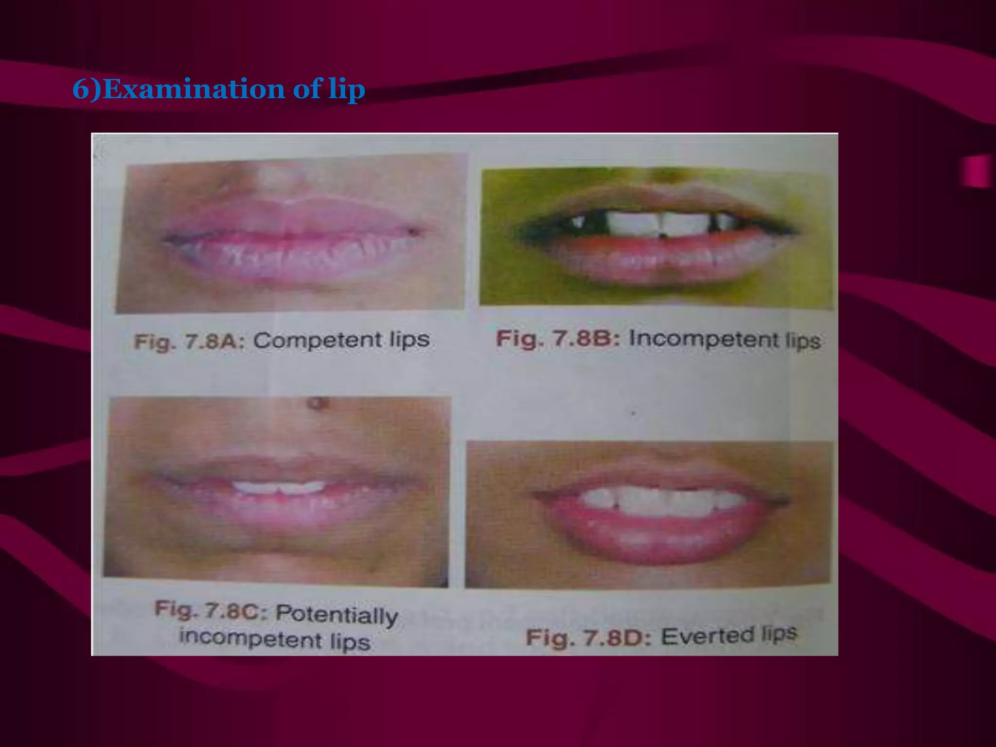 Facial evaluation by Dr Pooja Shroff | PPT