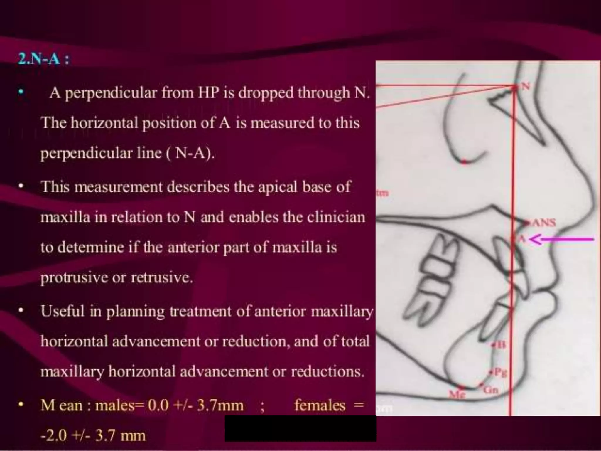 Facial evaluation by Dr Pooja Shroff | PPT