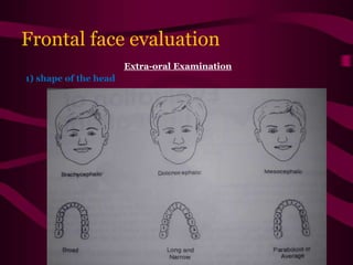 Facial evaluation by Dr Pooja Shroff | PPTX