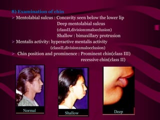 Facial evaluation by Dr Pooja Shroff | PPTX