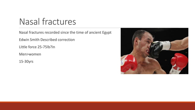 Facial fracture | PPTX