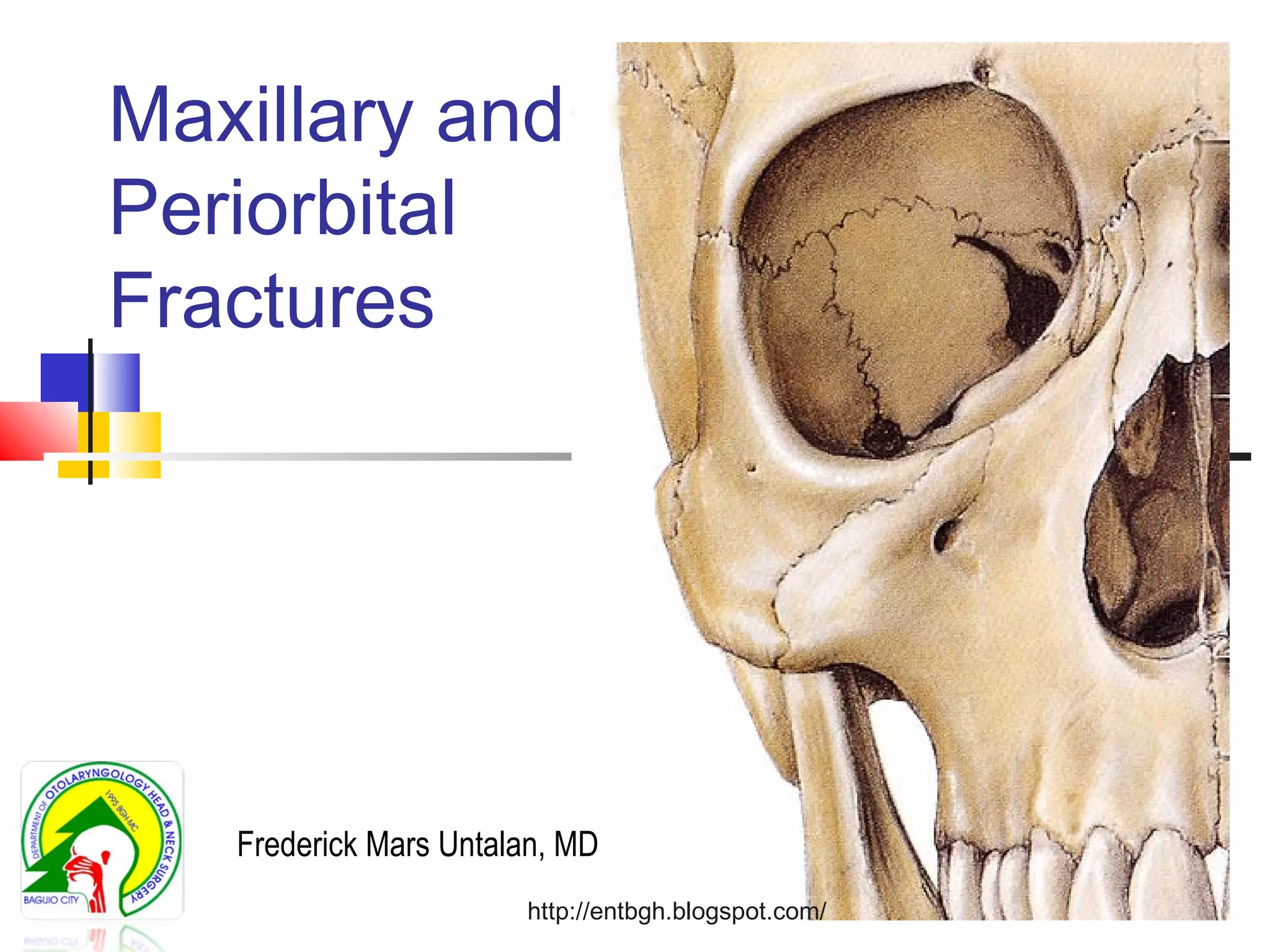 Facial fractures the upper face | PPT