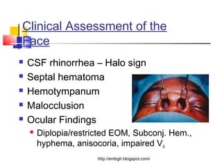 Facial fractures the upper face | PPT