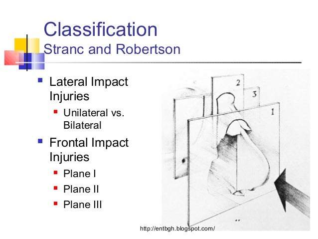 Facial fractures the upper face