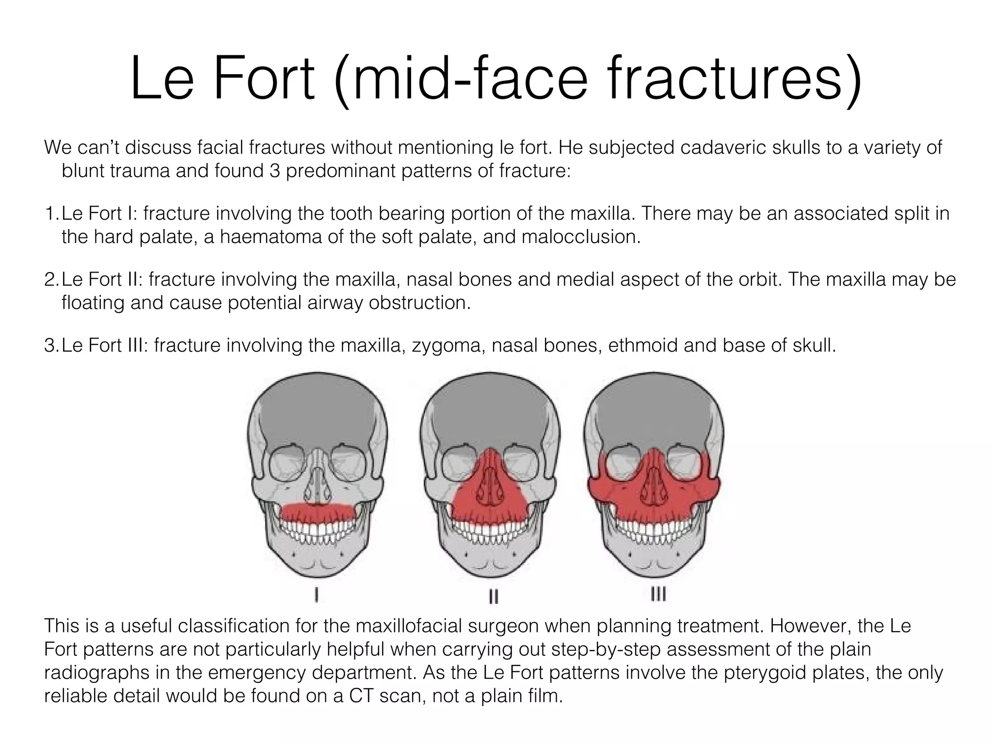 Management of Facial Fractures in ED | PPT