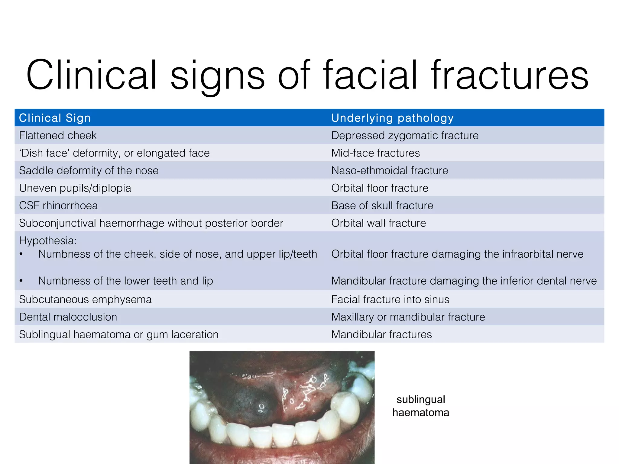 Management of Facial Fractures in ED | PPT