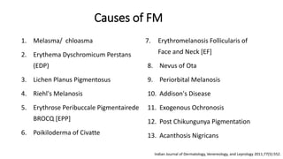 Facial hypermelanosis | PPTX
